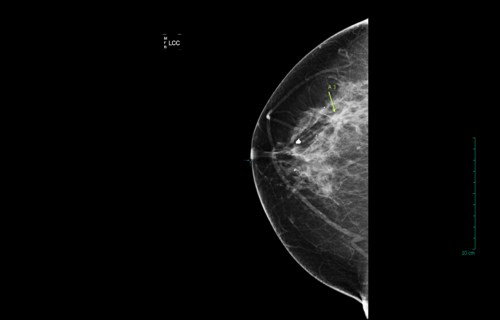 Case Study #2 « Stacey Vitiello, M.D.